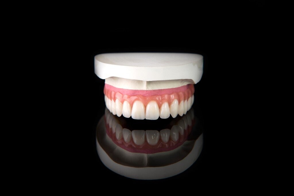 Stegprothese: Alle Infos - Gelencsér Dental